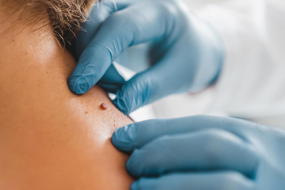 Skin Checks - Durham Health